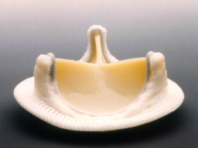 Heart Valve Prosthesis Heart Valve Performance Laboratory Heart Valve Prosthesis Heart Valve Performance Laboratory