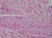 Peripheral Nerve Injuries: Practice Essentials, Anatomy, Pathophysiology
