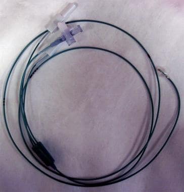 Transvenous Cardiac Pacing Periprocedural Care: Equipment