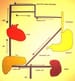 Esophageal Varices Imaging and Diagnosis: Practice Essentials ...