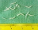 Pinworm (Enterobiasis) Workup: Approach Considerations, Laboratory ...