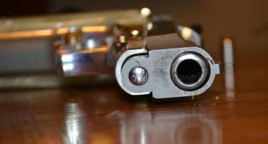 Forensic Pathology of Firearm Wounds: Overview, Modern Ammunition ...