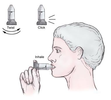 Use of Metered Dose Inhalers, Spacers, and Nebulizers: Overview ...