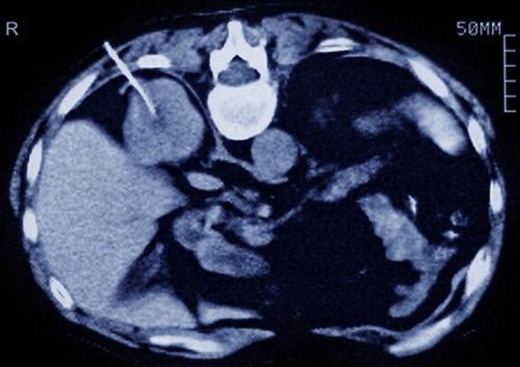 Desafio Diagnóstico: Jovem de 19 anos com confusão e insuficiência ...