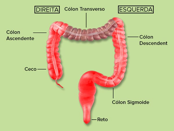 À direita ou à esquerda? Posição do câncer colorretal faz diferença
