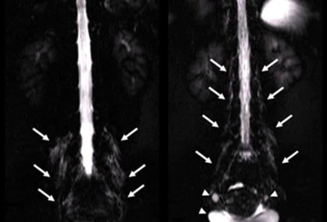 Boas Práticas: punção lombar