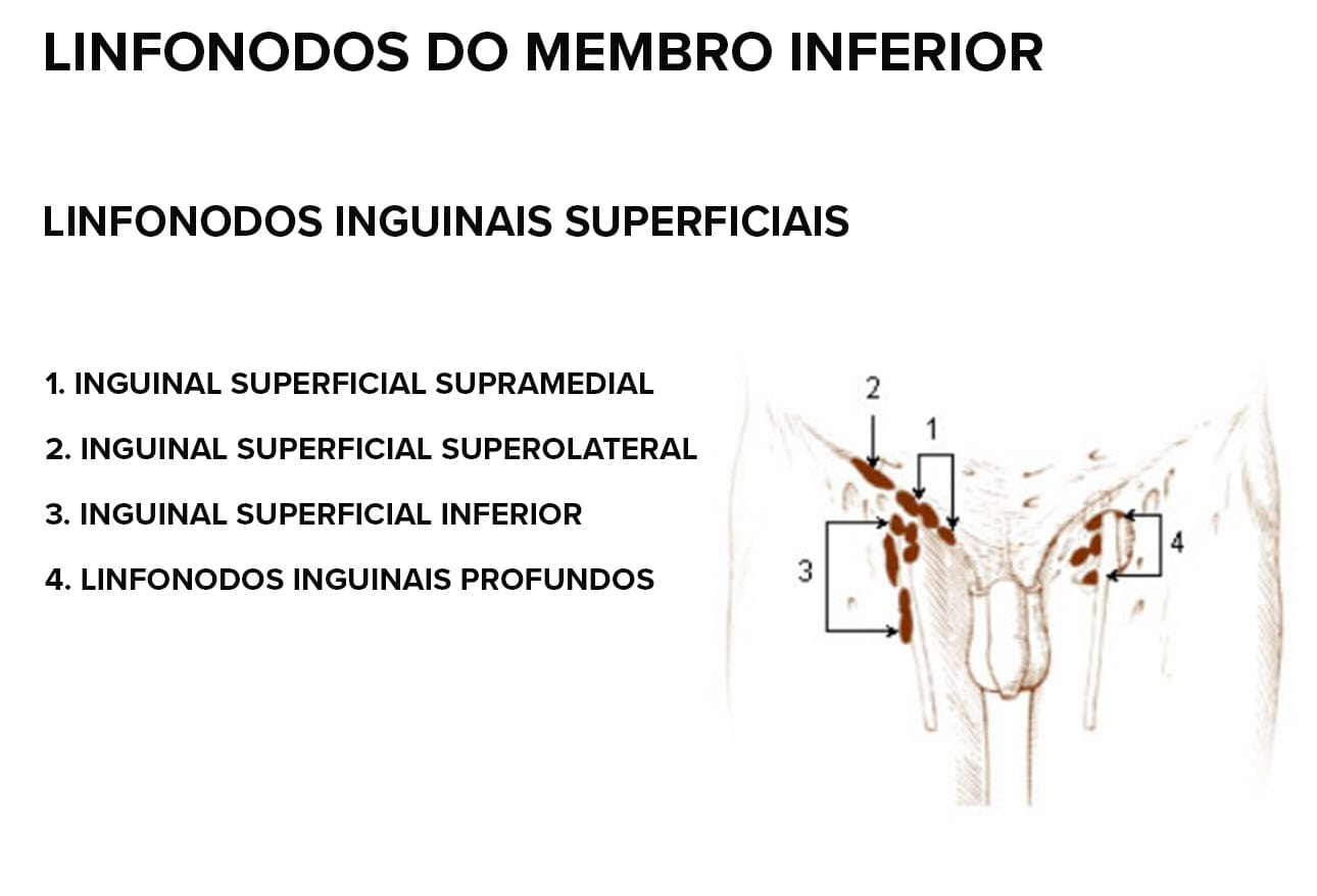 Câncer de pênis: nove casos para testar seu conhecimento