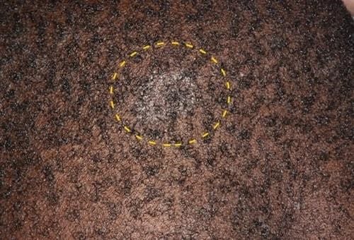 Identificando lesões em peles negras