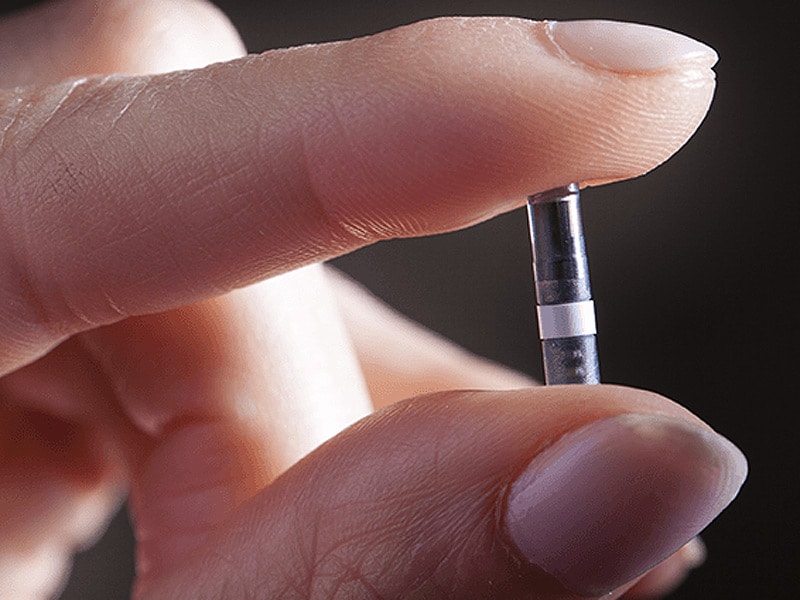 Sensor de glicemia implantável é seguro e preciso por 6 meses