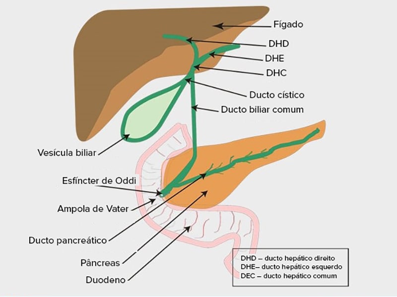 Slide Do Ducto Pancreatico