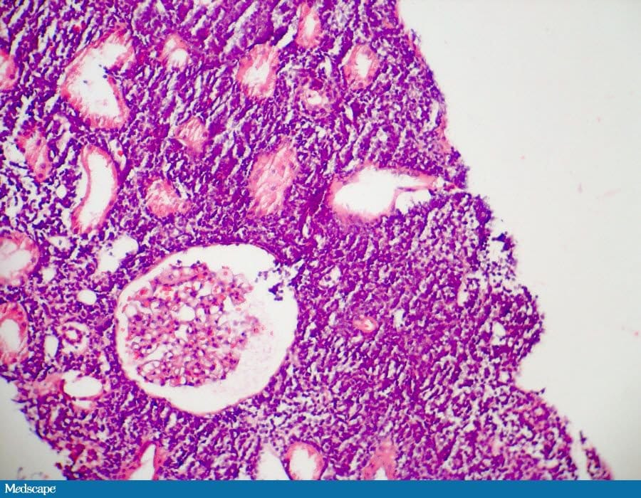 Homem de 32 anos vomitando sangue