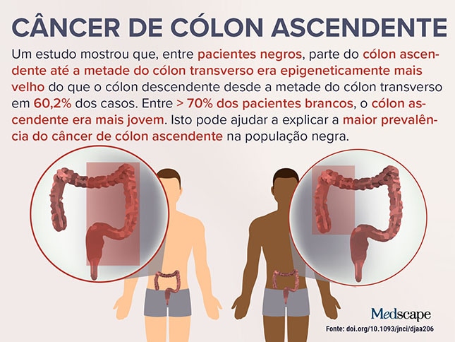 Temas mais buscados: Câncer de cólon ascendente