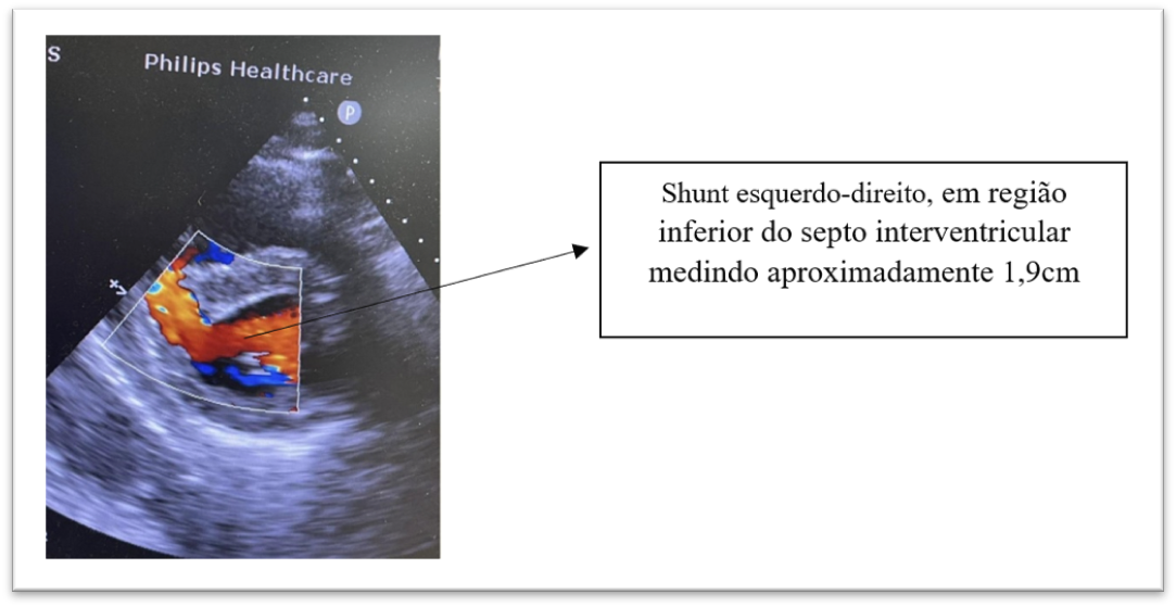 Caso Clínico: Homem de 46 anos apresenta dor torácica retroesternal com ...