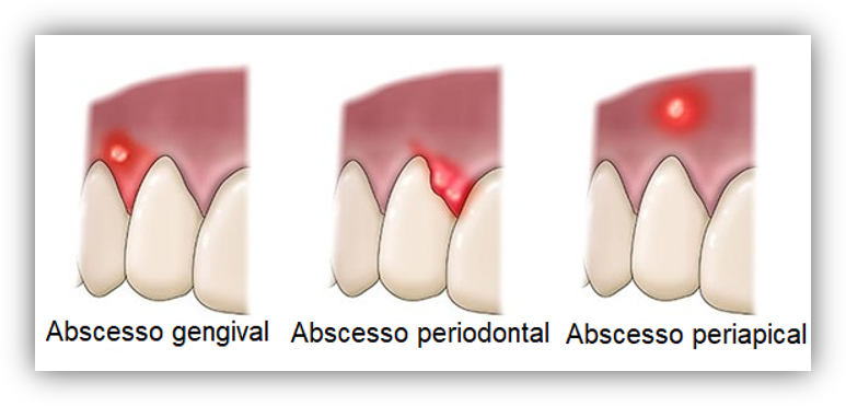 Homem hipertenso apresenta mudança de personalidade recente