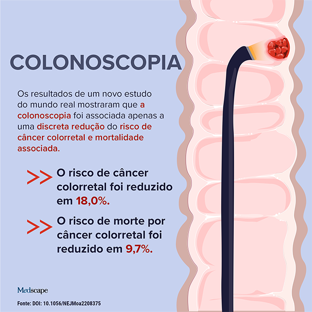 Temas mais buscados: Colonoscopia