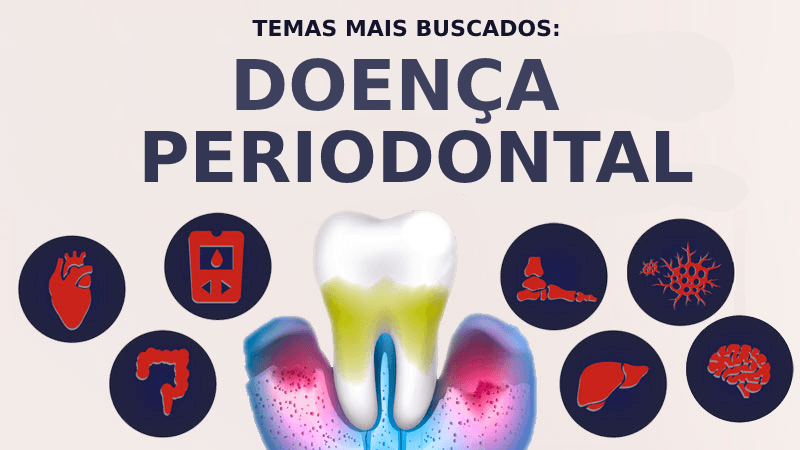 Doenca Periodontal