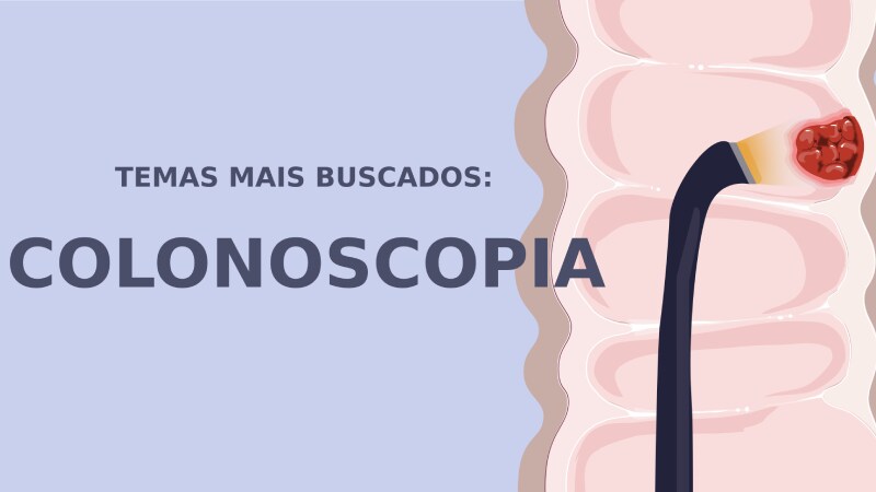 Temas mais buscados: Colonoscopia