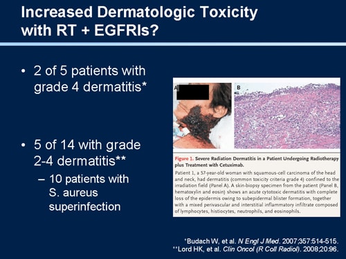 Management of Dermatologic and Other Toxicities Associated With EGFR ...