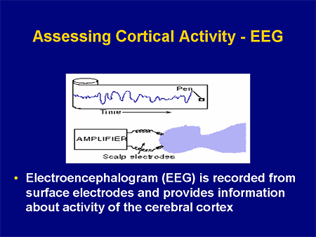 Sustaining Wakefulness in Excessive Sleepiness: Consequence Prevention