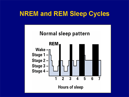 Sustaining Wakefulness in Excessive Sleepiness: Consequence Prevention