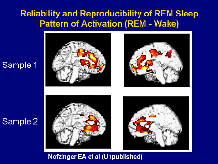 Sustaining Wakefulness in Excessive Sleepiness: Consequence Prevention