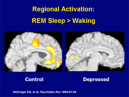Sustaining Wakefulness in Excessive Sleepiness: Consequence Prevention