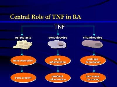 New Standards of Care for Rheumatoid Arthritis