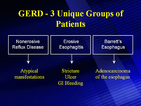 New Horizons in Acid Suppression of GERD: Evaluation of the Evidence