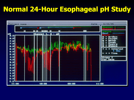 Not All Heartburn Patients Are Equal: Strategies for Coping With...