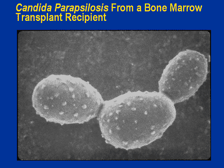 Optimizing Patient Management in the ICU: Focus on Anemia, ARDS, and...