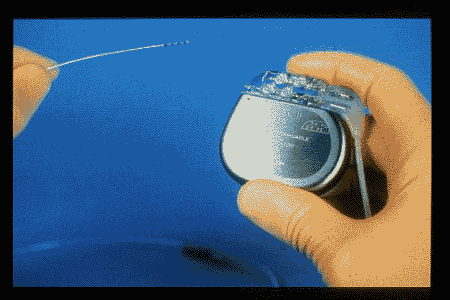 Innovative Epilepsy Therapies for the 21st Century - Part 2