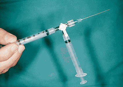 Opposing Views in the Treatment of OA of the Knee