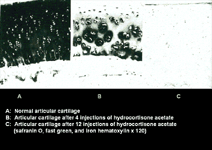 Opposing Views in the Treatment of OA of the Knee