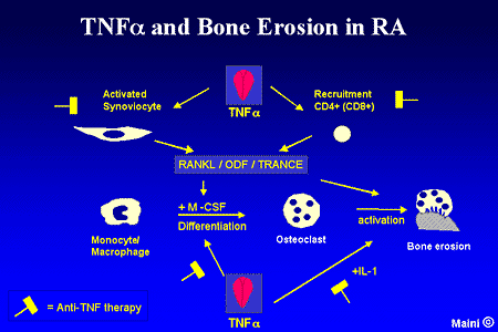 Structural Damage in Rheumatoid Arthritis