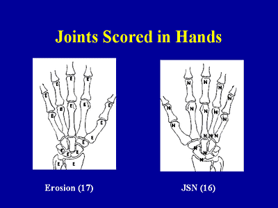 Structural Damage in Rheumatoid Arthritis