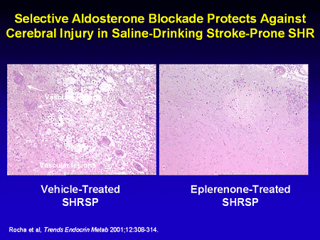 New Insights Into the Role of Aldosterone in Cardiorenal Disease and...