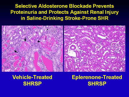 New Insights Into the Role of Aldosterone in Cardiorenal Disease and...