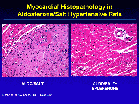New Insights Into the Role of Aldosterone in Cardiorenal Disease and...