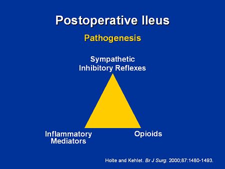 Current and Emerging Pharmacotherapy for Postoperative Ileus