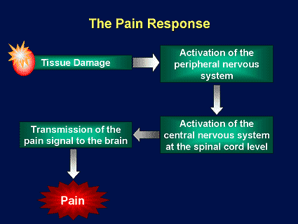 A New Era in Pain Management With COX-2 Specific Inhibitors