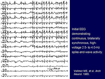 Special Challenges in Status Epilepticus