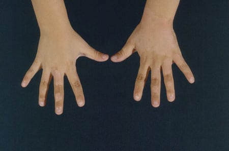 Masters of Pediatrics: Dermatology