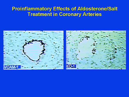 Impact of the RAAS on CVD: Is Early Intervention Better?