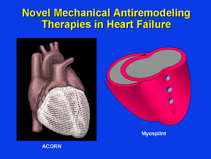 Impact of the RAAS on CVD: Is Early Intervention Better?