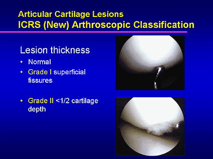 OA Today and Tomorrow: Maintaining Function with Early Intervention
