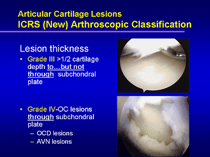 OA Today and Tomorrow: Maintaining Function with Early Intervention