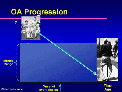 OA Today and Tomorrow: Maintaining Function with Early Intervention