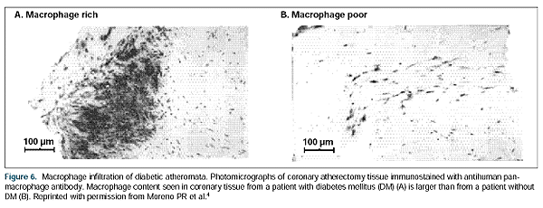 Diabetes and Cardiovascular Disease: The Role of the Glycoprotein IIb ...