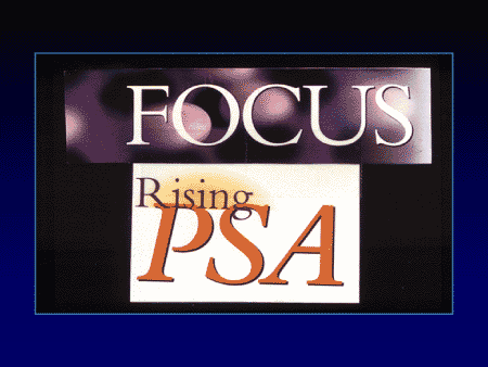 Emerging Concepts in the Treatment of Prostate Cancer