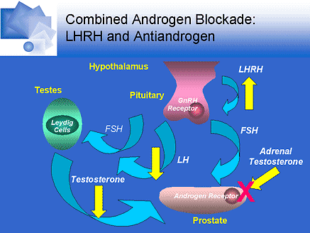 Hormonal Therapy for Prostate Cancer: Controversies and Advances